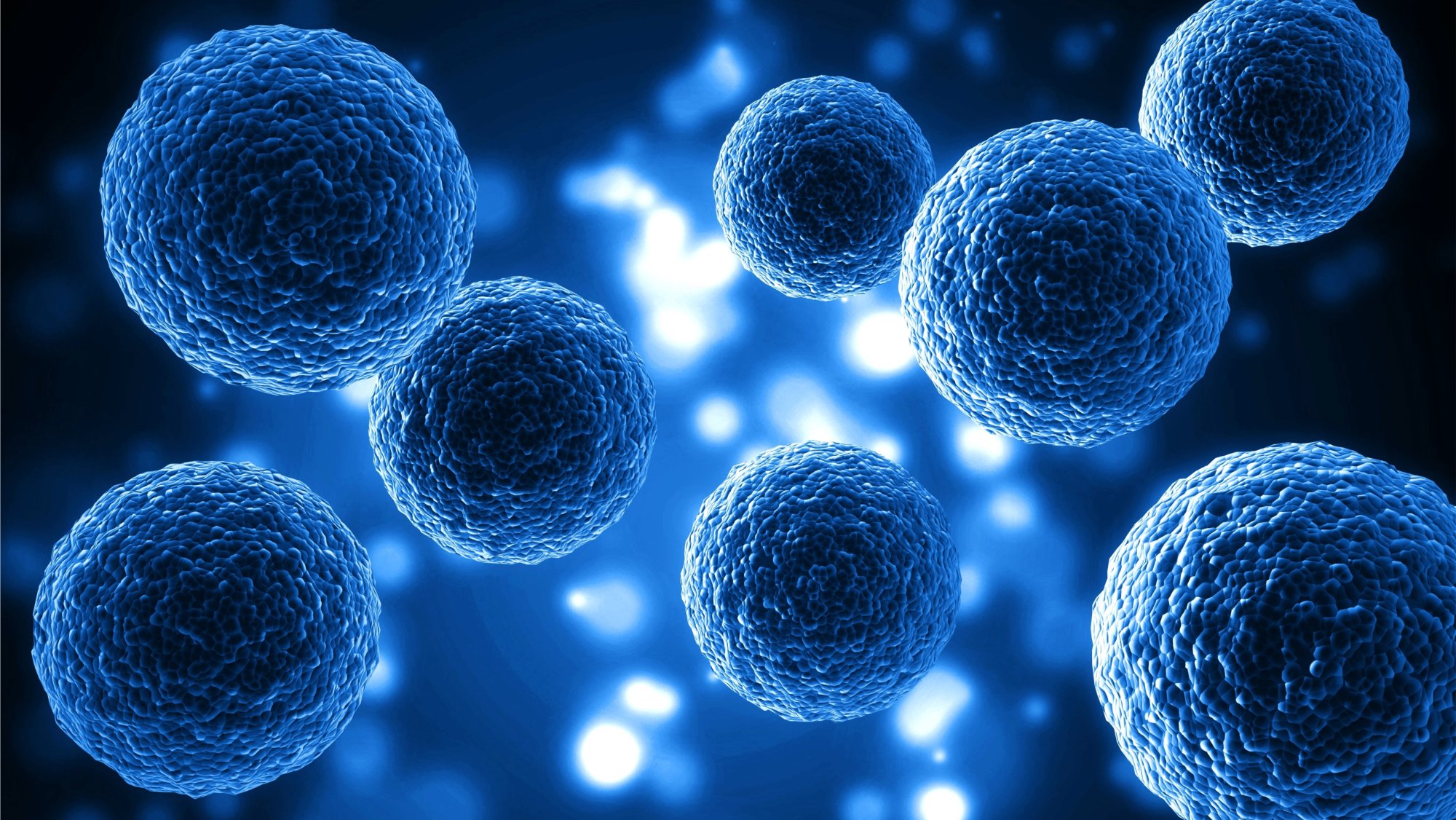 GS Xceed® Gene Expression System | Lonza